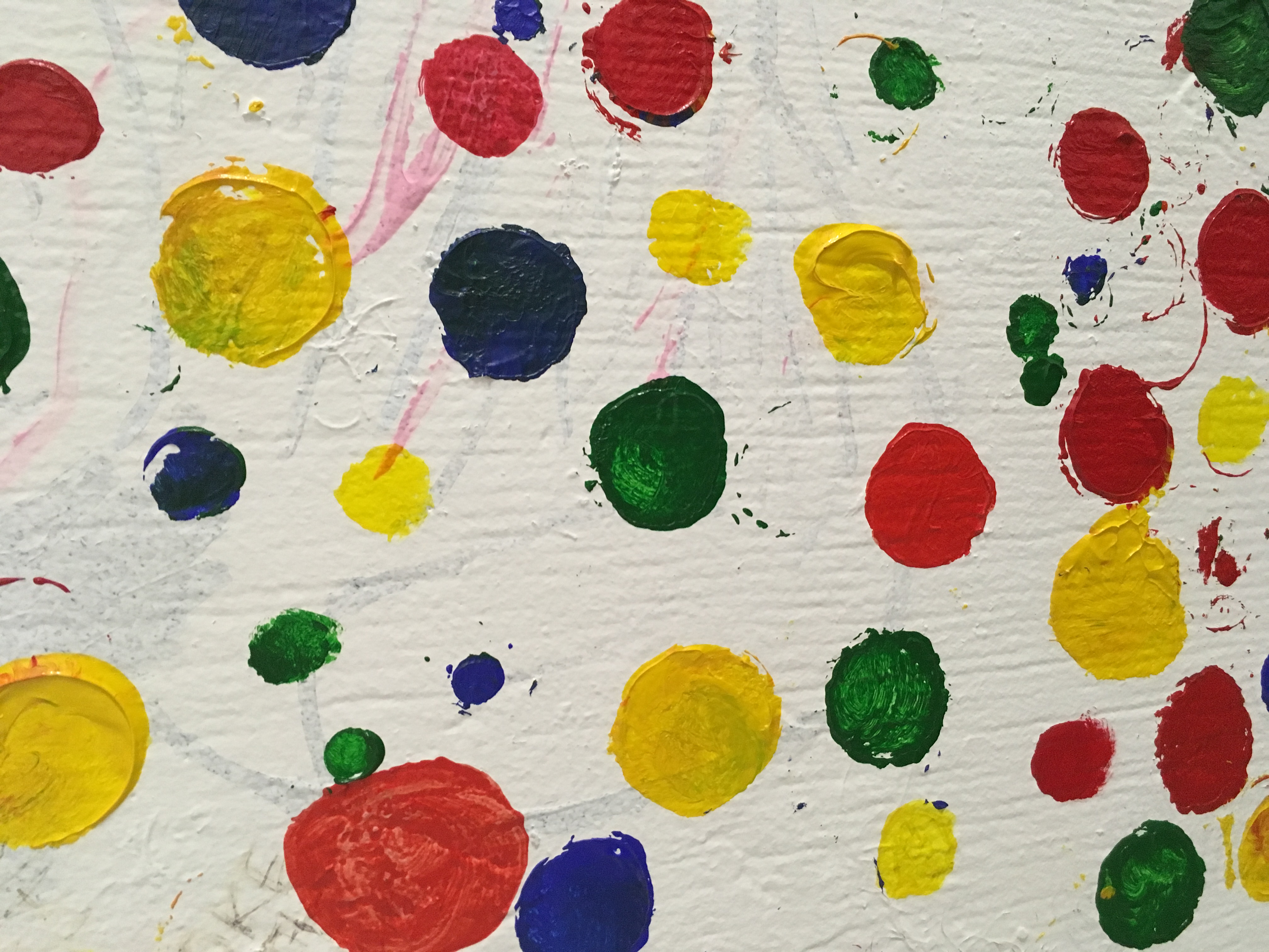 IMG_3178 – Complex Loss