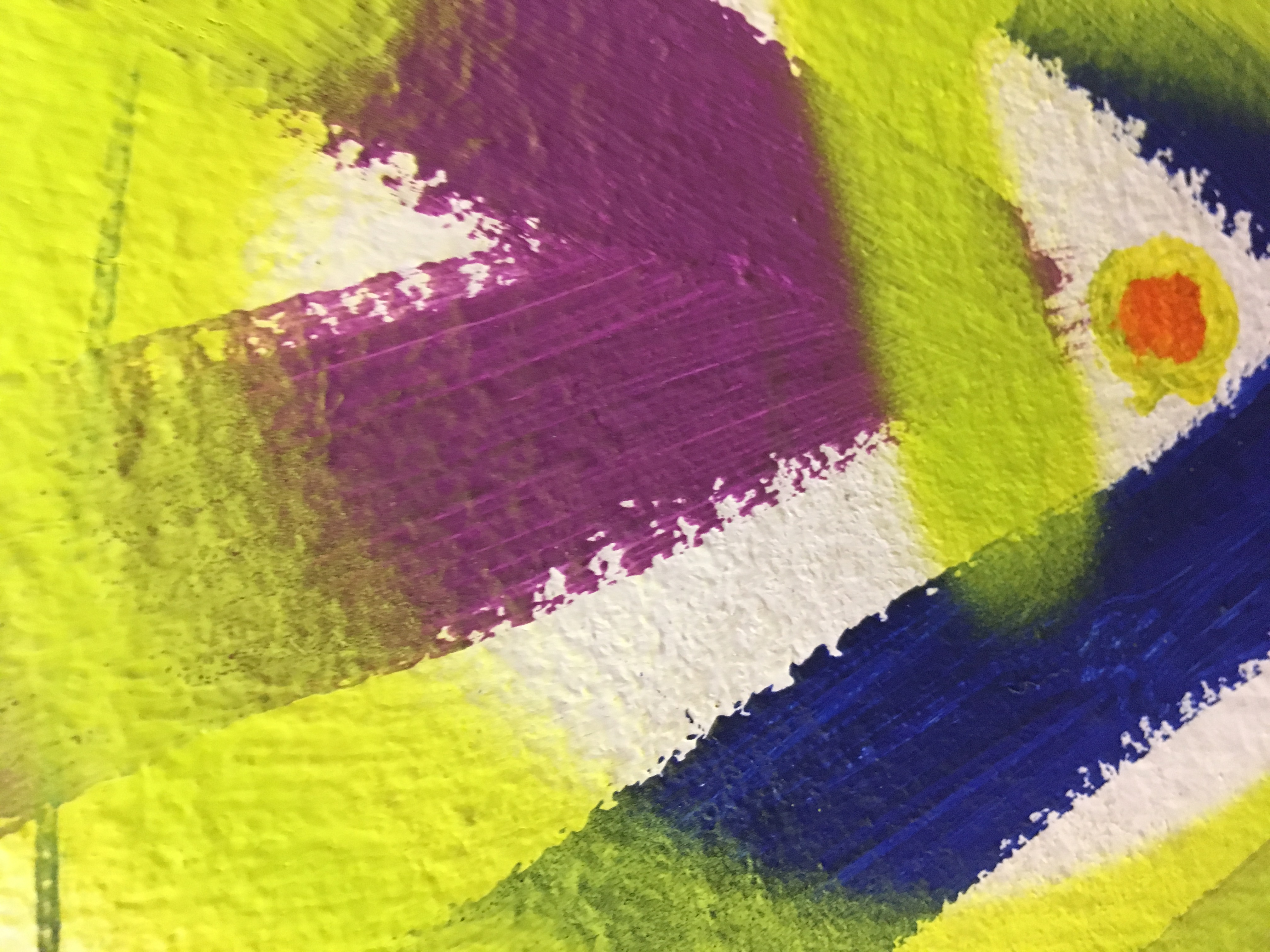 IMG_3554 – Complex Loss